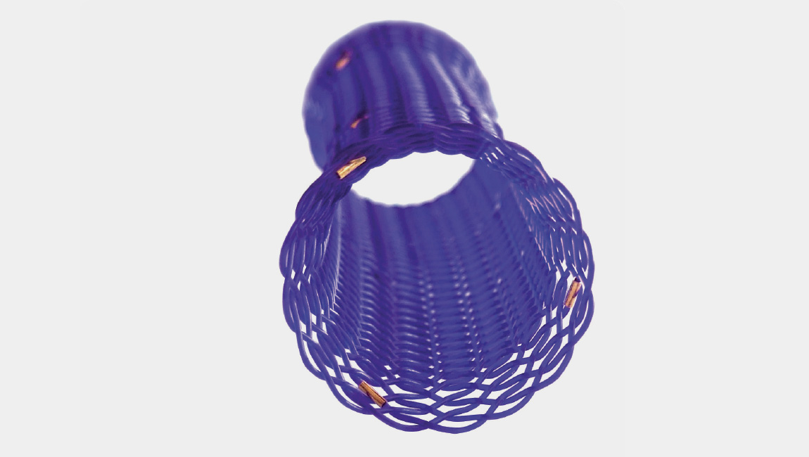 Biodegradable Stent - Its Interventional