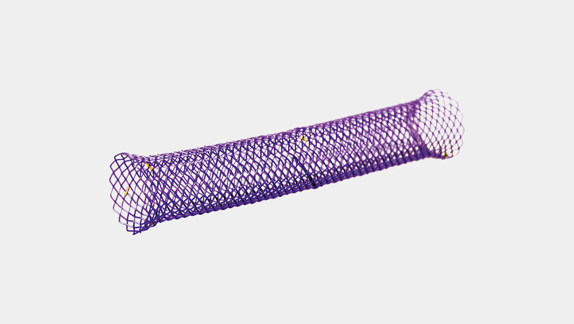 Biodegradable Stent - Its Interventional