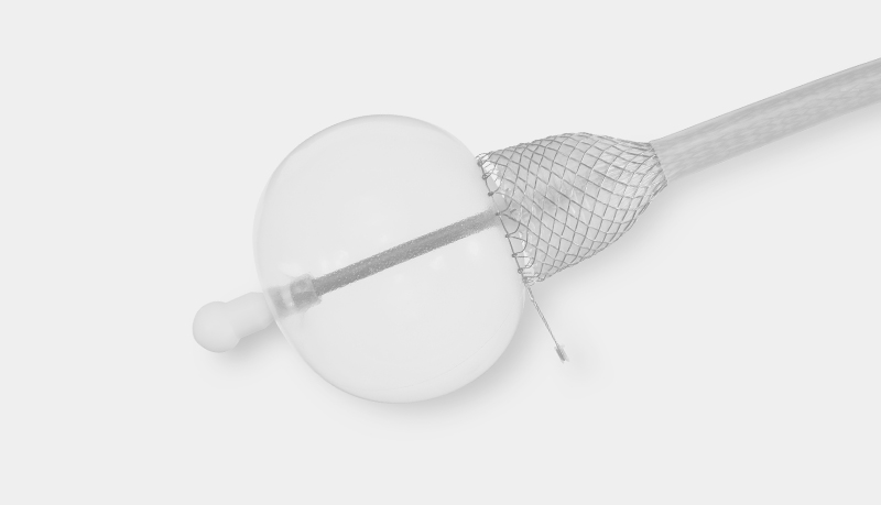 Danis Stent - Its Interventional